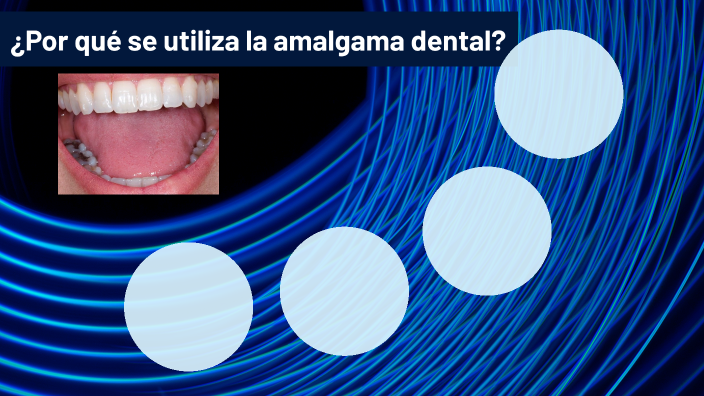 El uso de la amalgama by Berenice Guzmán on Prezi