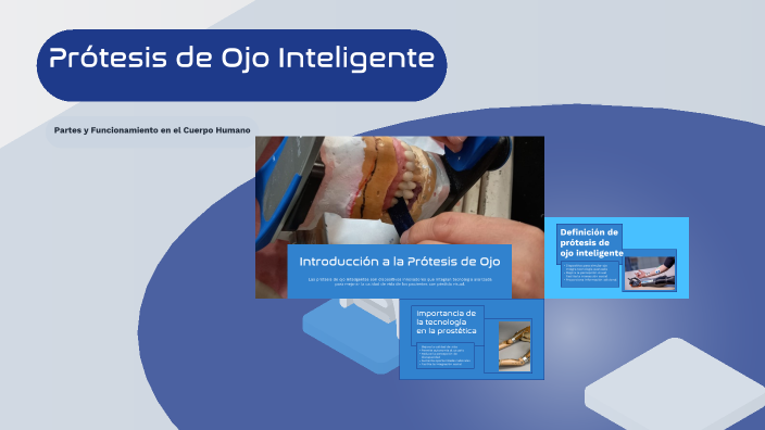Prótesis de Ojo Inteligente by Keyla Tapia on Prezi