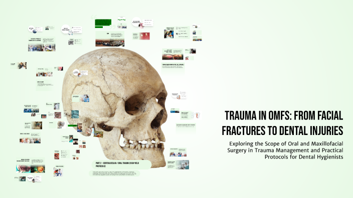Trauma in OMFS: From Facial Fractures to Dental Injuries by Michael ...
