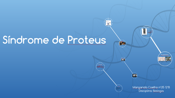Síndrome de Proteus by Margarida Coelho on Prezi