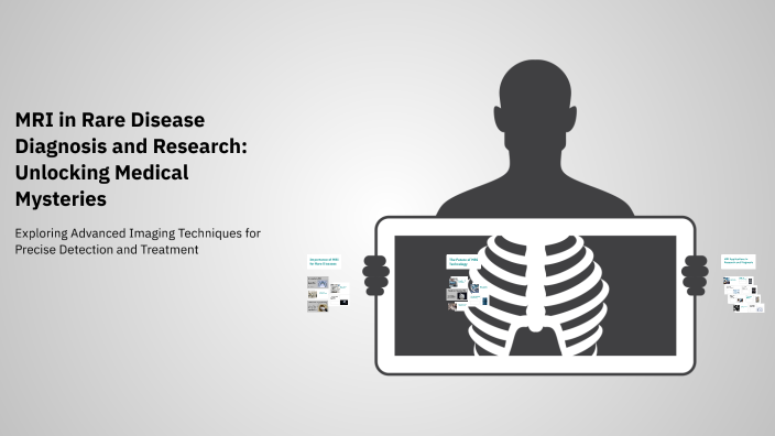 MRI in Rare Disease Diagnosis and Research: Unlocking Medical Mysteries ...