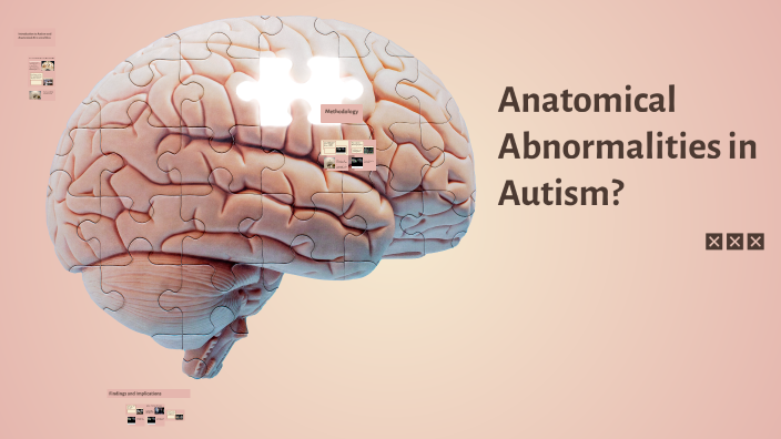 Anatomical Abnormalities in Autism by shai shehory on Prezi