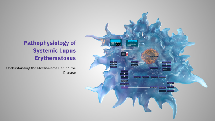 Pathophysiology of Systemic Lupus Erythematosus by Matthew C. Agustin ...