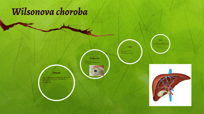 Wilsonova choroba by Ondřej Hájek on Prezi