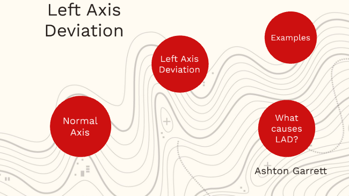 Left Axis Deviation by Ashton Garrett on Prezi