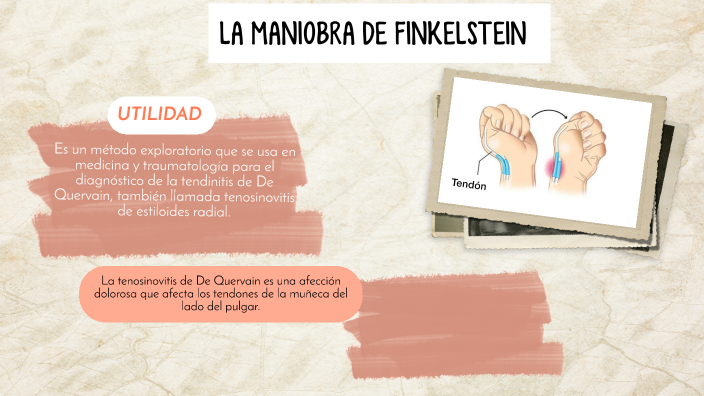 La maniobra de Finkelstein by C_ Zillmann on Prezi