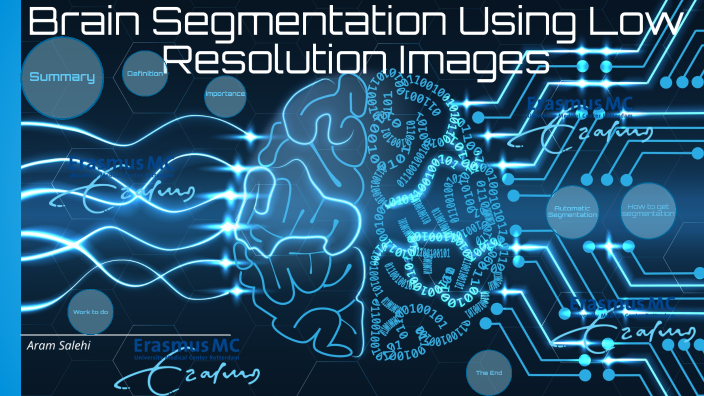 Brain Segmentation Using Low Resolution Images by aram salehi on Prezi