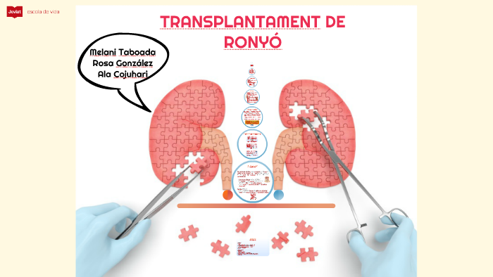TRANSPLANTAMENT DE RONYÓ by Ala Cojuhari on Prezi