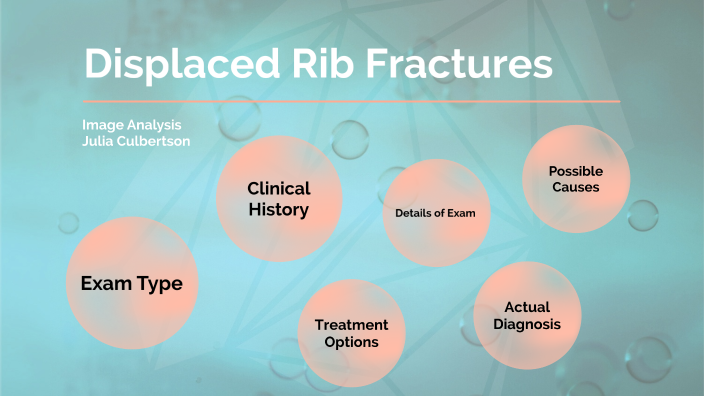 Displaced Rib Fracture by Julia Culbertson on Prezi