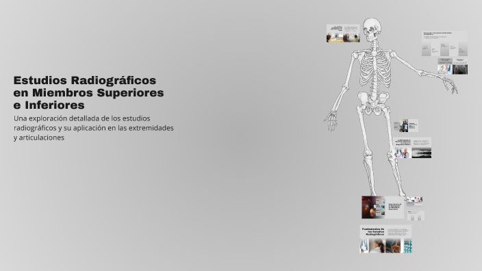 Estudios Radiográficos en Miembros Superiores e Inferiores by andrea ...