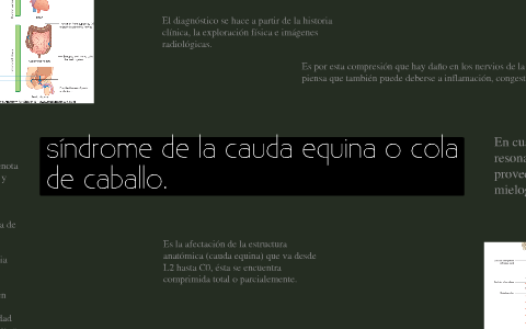 Síndrome de cauda equina o cola de caballo by Natalia Sánchez Garrido ...