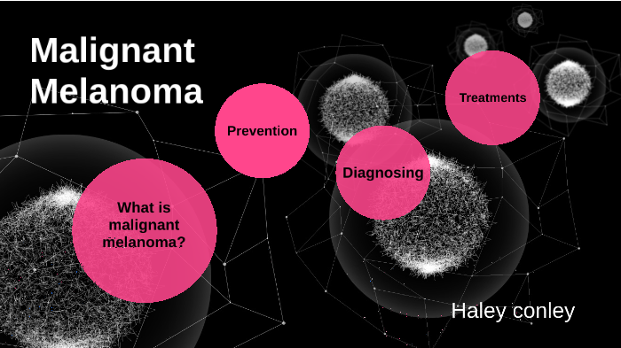 malignant melanoma by haley conley on Prezi