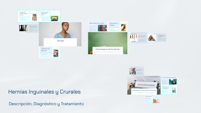 Hernias Inguinales y Crurales by Julia Silva Carravieri Cuesta on Prezi