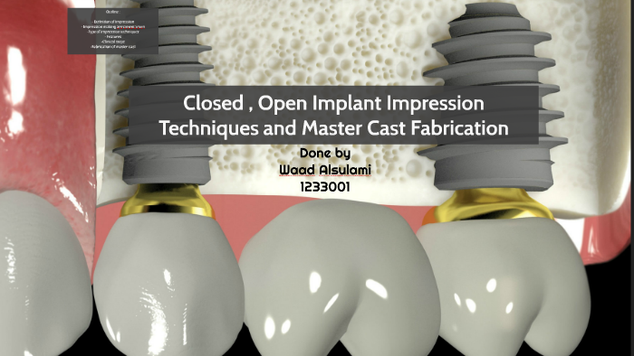 Closed , Open Impression Techniques and Master Cast Fabricat by Waad Essa