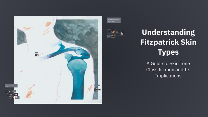 Understanding Fitzpatrick Skin Types by makalynn lehr on Prezi