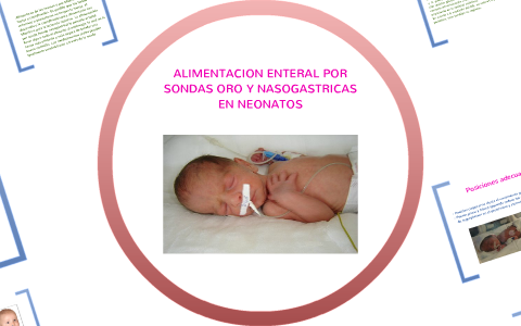 Alimentacion Por Sondas Oro Y Nasogastricas En Neonatos By Ana Lazaro