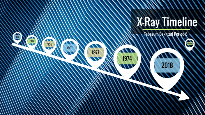 X-Ray Timeline by TABASUM BAKHTARI on Prezi
