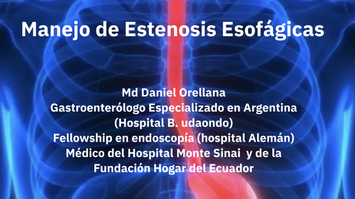 Manejo de Estenosis Esofágicas Benignas by daniel orellana on Prezi