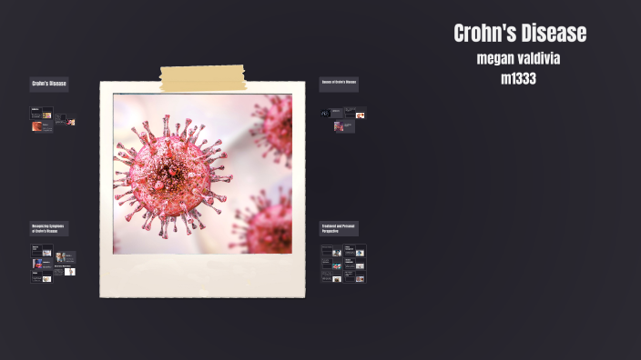 Understanding Crohn’s Disease by Megan Valdivia on Prezi