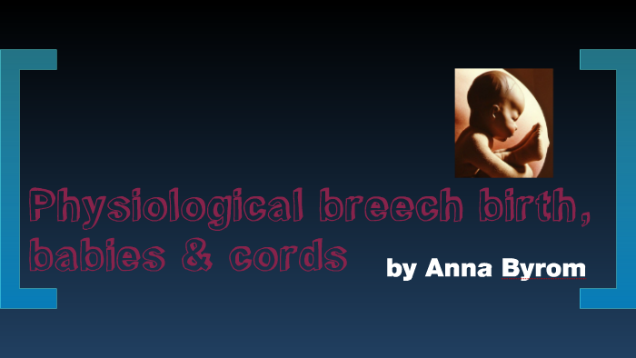 MW2305 Breech babies by Anna Byrom on Prezi