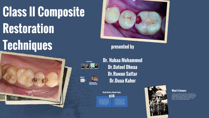 Class II Composite Restoration Techniques by nabaa mohammed on Prezi