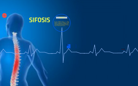 SIFOSIS by Maria Luz Carrasco Aguilar on Prezi