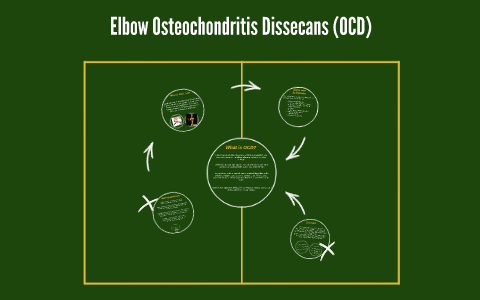 Elbow Osteochondritis Dissecans (OCD) by Carson Penner on Prezi
