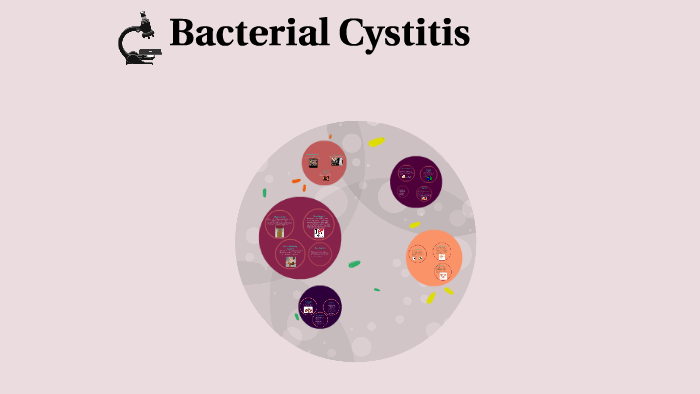 Bacterial Cystitis by Josephine Sanchez on Prezi