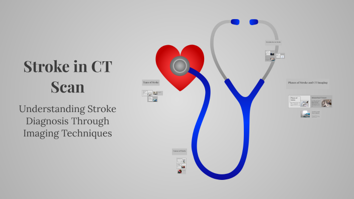 Stroke in CT Scan by Khalid Hakami on Prezi