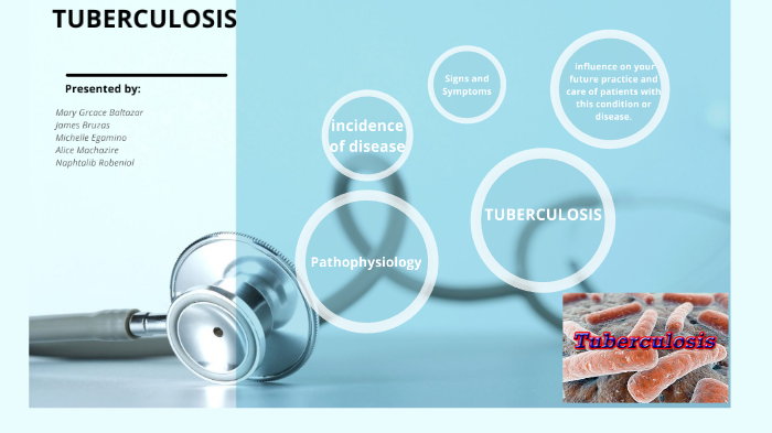 TB Concept Map by James Bruzas on Prezi