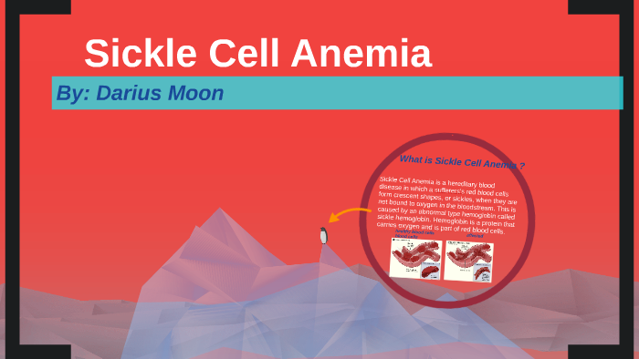 Human Anatomy Sickle Cell Project. by darius moon on Prezi
