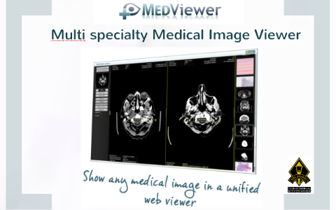 MEDViewer: Unified Medical Image Viewer by Miguel Cabrer on Prezi