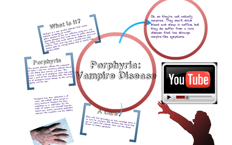 Vampire Disease by Jessica Anastasio