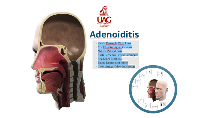 Adenoiditis by Kathia Chan on Prezi
