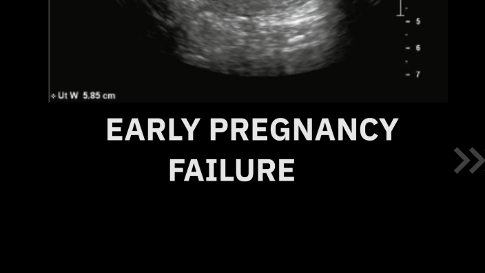 Advanced maternal age: Risk increases significantly with age (e.g., 75 ...