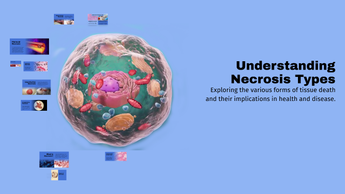 Understanding Necrosis Types by شهد 'ۦ on Prezi