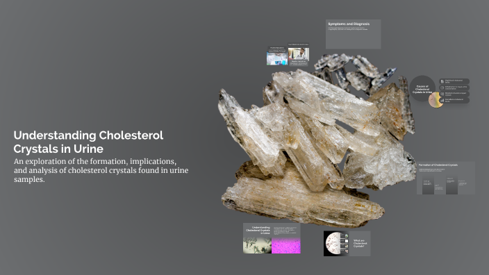 Understanding Cholesterol Crystals in Urine by Lizette Jacobo on Prezi