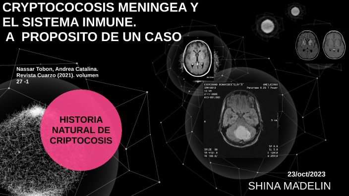 criptococosis by ZhynaD Benavides on Prezi