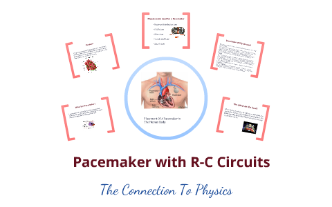 Pacemaker Connection To Physics by Suraj Jena on Prezi