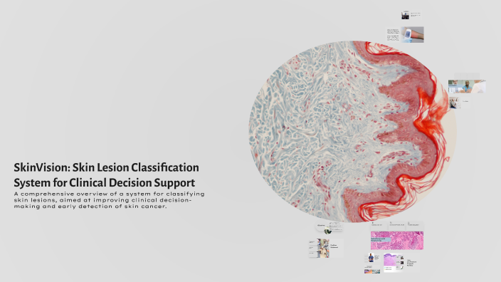 SkinVision: Skin Lesion Classification System for Clinical Decision ...