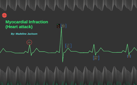 Myocardial Infraction (Heart attack) by Madeline Jackson on Prezi