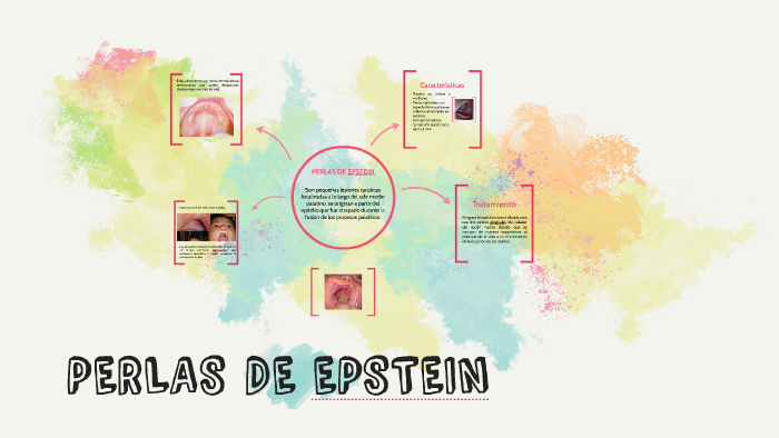 PERLAS DE EPSTEIN by Karen Escalante on Prezi