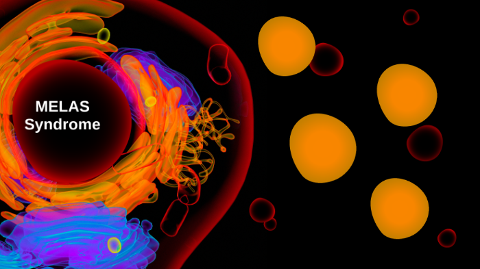 MELAS Syndrome by Elizabeth Gonzalez on Prezi