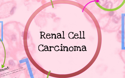 Renal Cell Carcinoma by Emma Feigenbaum on Prezi