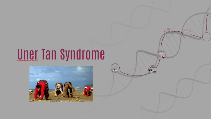 Uner Tan Syndrome by Brianna Keeling on Prezi