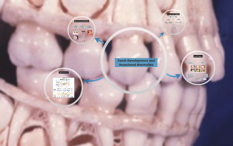 Tooth Development and Associated Anomalies by Katie Egbert on Prezi