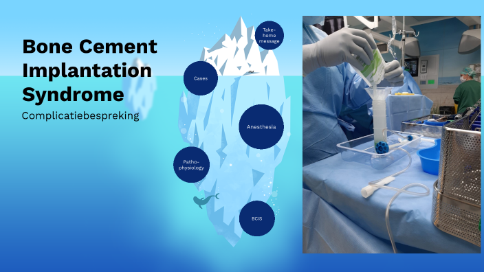 Bone Cement Implantantation Syndrome by Bernard Houweling on Prezi