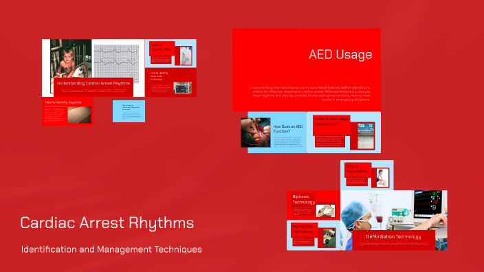 Cardiac Arrest Rhythms by Patrick Johnston on Prezi