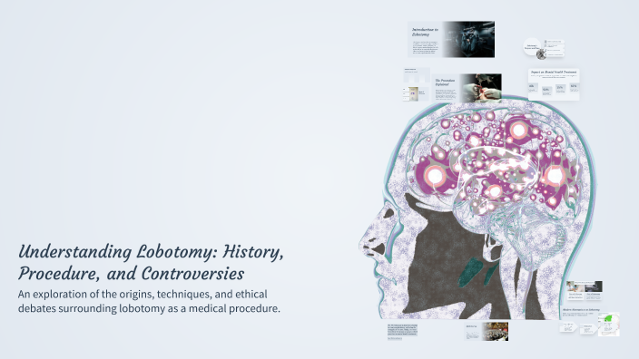 Understanding Lobotomy: History, Procedure, and Controversies by Ava O ...