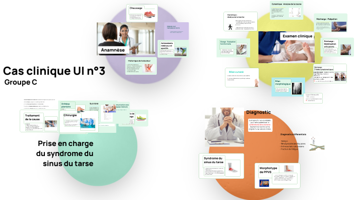 Évaluation et prise en charge du syndrome du sinus du tarse by Elise ...